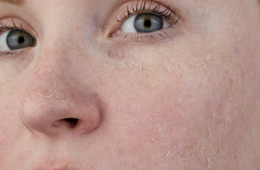 Soins hydratants pour peaux très sèches – Laboratoires Novexpert